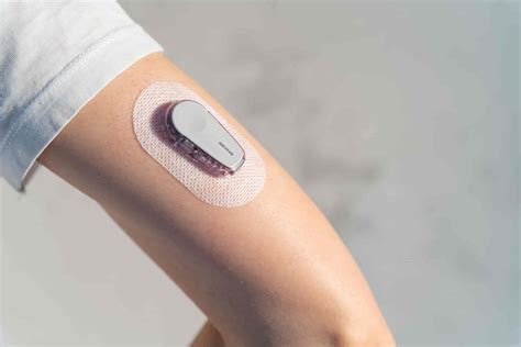 Continuous Glucose Monitoring