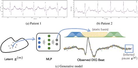 Figure 1 From A Hierarchical Generative Model Of Electrocardiogram