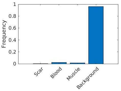 Myi Net Fully Automatic Detection And Quantification Of Myocardial Infarction From