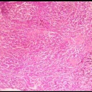 Sex Wise Distribution Of Lung Lesions Download Scientific Diagram