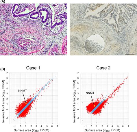 Rna Sequencing Analyses Of Ffpe Samples Using Laser Microdissection