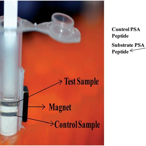 Application Of The Colorimetric Detection Methods A Biosensor Chip