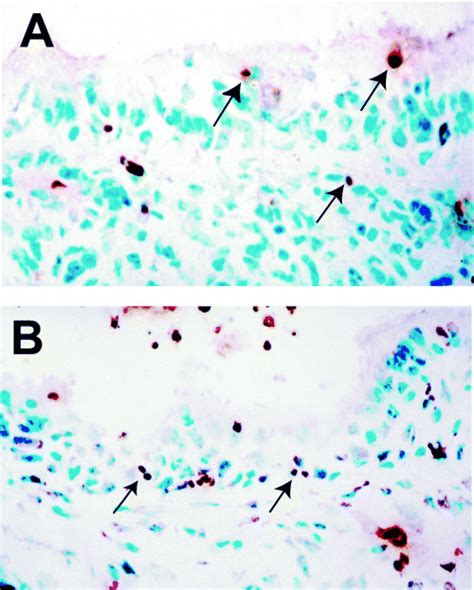 Allograft Tunel Positive Cells Tunel Staining Of Allografts No