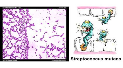 Streptococcus Mutans Agall1995