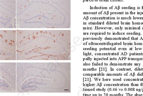 Immunohistochemical Anaylsis Of Injected Mice Using 82e1 Antibody Download Scientific Diagram