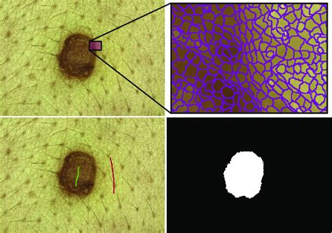 Segmentation Method Given A Dataset Coloured Central View Image