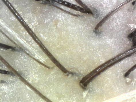 What Colour Is Your Scalp Yokos Haute Coiffure