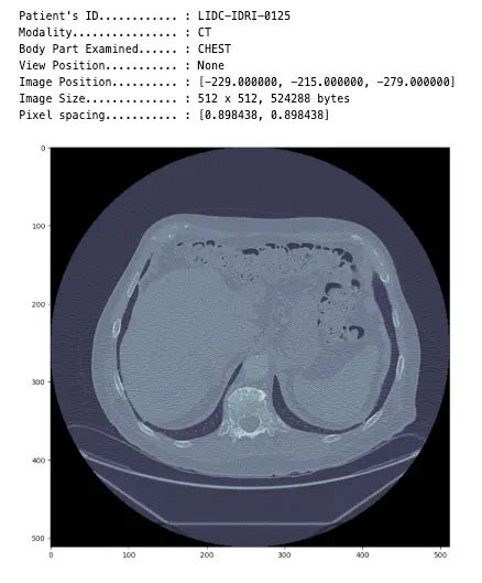 Improving Images Using Equalisation And Histogram Matching With Python By Edward Roe Medium