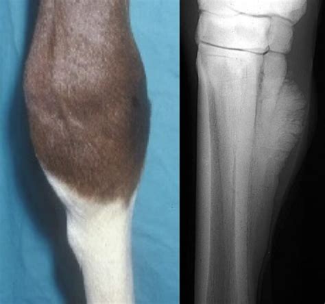 Metacarpal Or Metatarsal Exostosis Etiology And Treatment