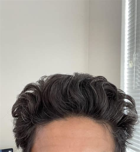 Help Needed With Awkward Length Stage Rmalehairadvice