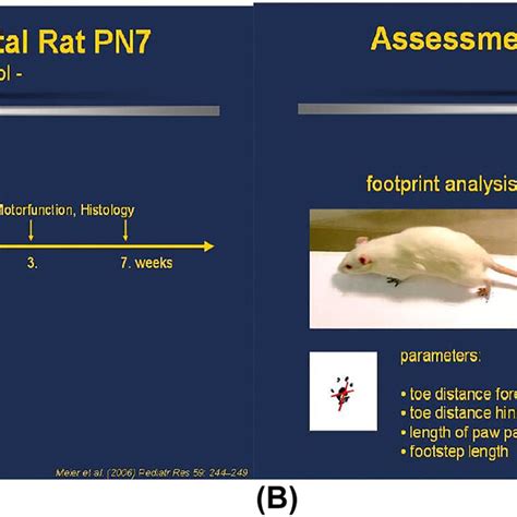 Acquired Cp Due To Global Hypoxic Ischemia Caused By Cardiac Arrest Download Scientific