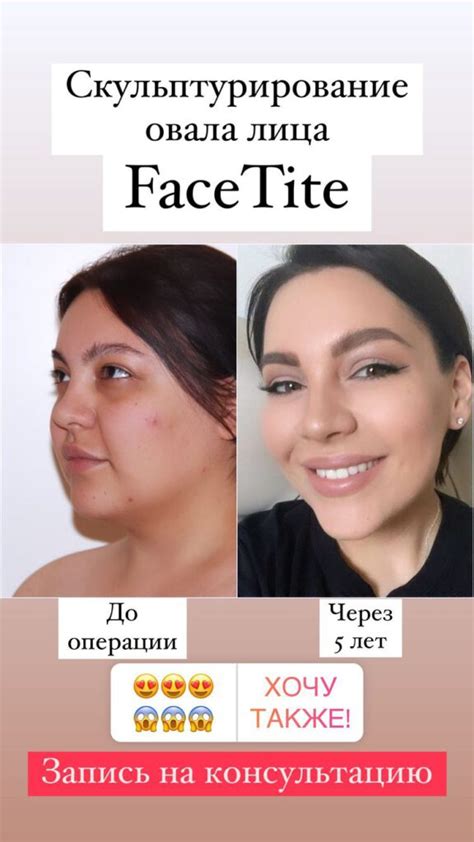 Пластична хірургія Офтальміка Естетікс