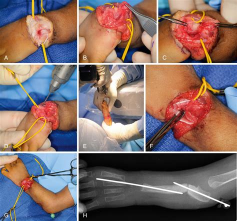 Malformations Of The Wrist And Forearm Clinical Tree