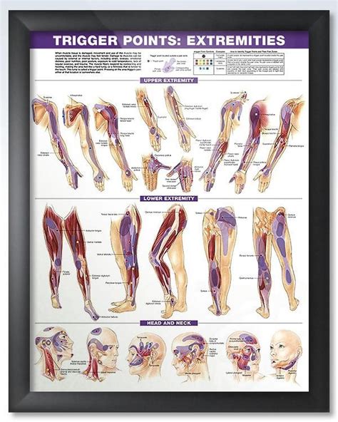 Trigger Points Set Anatomy Poster A Visual Reference Of Charts Chart Master