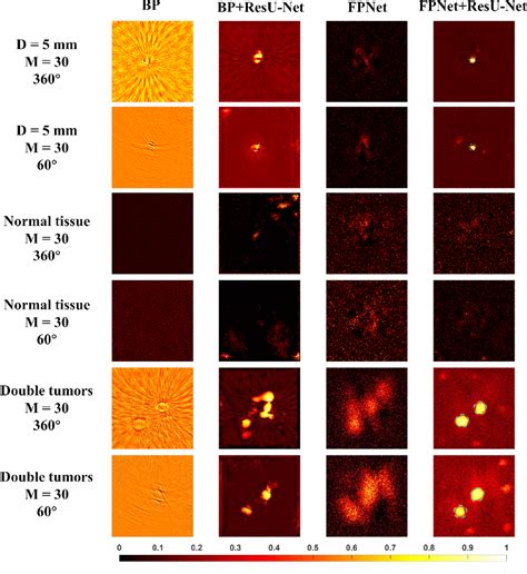 Figure 11 From Deep Learning Enabled Microwave Induced Thermoacoustic