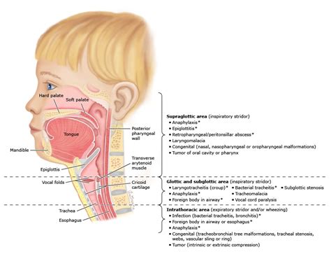Inspiratory Stridor Infectious Causes Of Upper Airway Obstruction