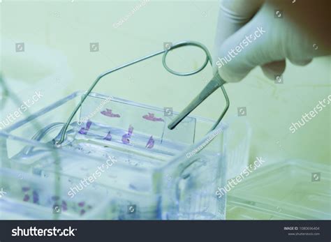 What Is Microscope Slide Staining At Jonathan Sharpe Blog