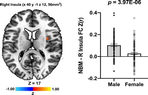 Significantly Greater Rsfc Between The Nbm And Right Insula In Male