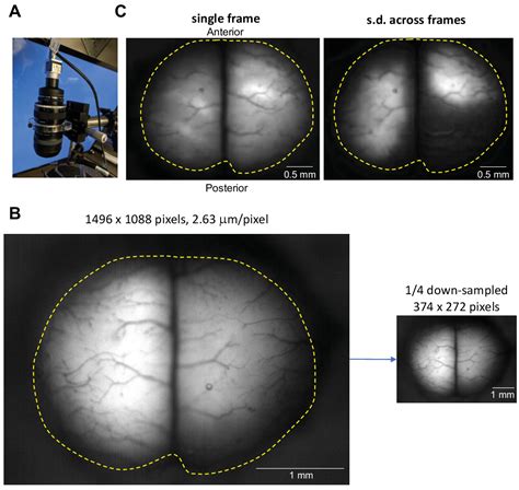 Calcium Imaging In Mouse Superior Colliculus