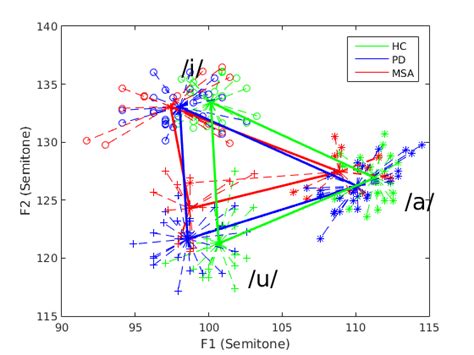 7 Vowel Space Using Three Corner Vowels O For I For U Download Scientific