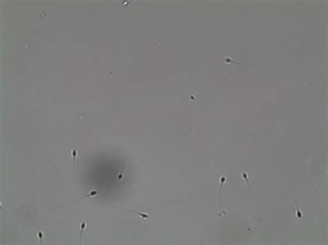 Automated Morphology Object Detection Roboflow Universe