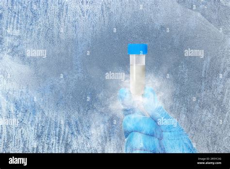 Cryopreservation Laboratory Assistant Holding Container With Sperm Closeup And Space For Text