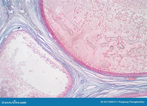 Leydig Cells Klinefelter Syndrome Royalty Free Stock Image 117239290