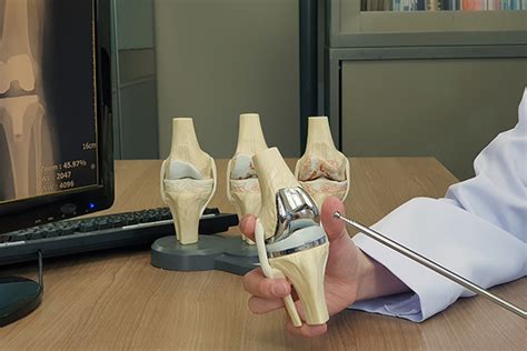 Understanding The Difference Between Total And Partial Knee Replacement