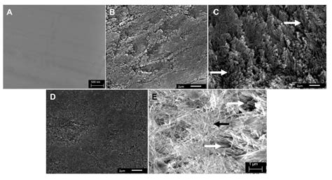 Joel Basilan On Linkedin Potential Of Mouthwashes To Repair Acid Eroded Tooth Surface Ccide