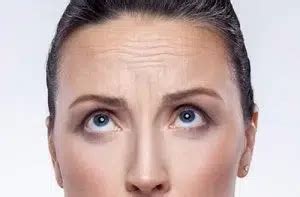 Daxxify Side Effects What To Know Before Trying Injectco