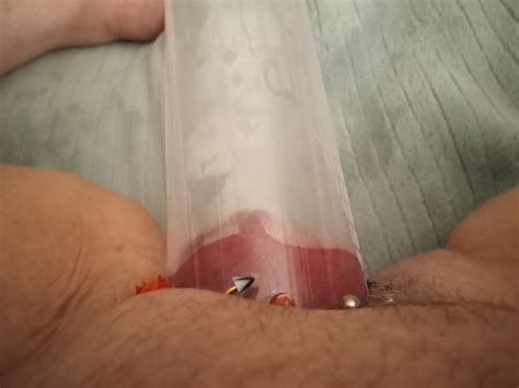 Pumped Clit With A Penis Poump 1 Pics Xhamster