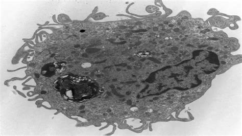 Human Cell Model Aids Understanding Of Tuberculosis Technology Networks