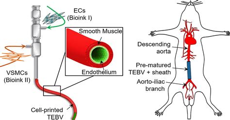 인공 혈관을 만드는 바이오 3d 프린팅