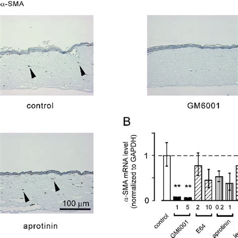 Schematic Diagram Of Dermal Fibroblast Differentiation Induced By Download Scientific Diagram