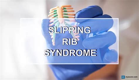 Slipping Rib Syndrome Symptoms Diagnosis Treatment And More Mya Care