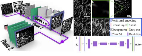 figure 1 from self similarity based super resolution of photoacoustic