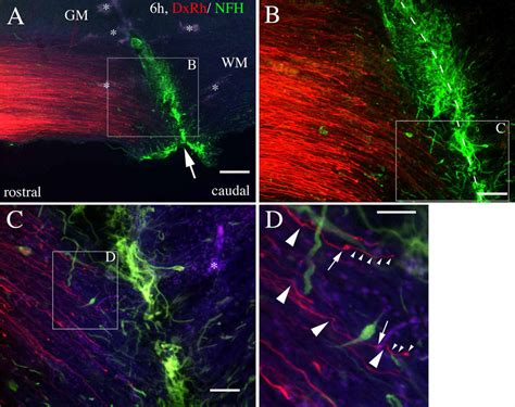 Regenerative Pioneering Axons Never Traverse The Aggregate Forming Axon Download Scientific