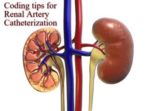 Selective Catheterization Tips For Cpt Code 36251 36252 36253 And 36254 Medical Coding Coding