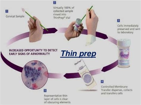 Cell Block And Liquid Based Cytology