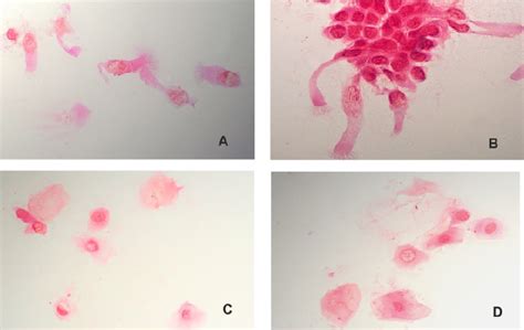 Figure 1 From Comparison Of Antigen Tests And Qpcr In Rapid Diagnostics Of Infections Caused By