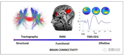 the neuroscientist：整合tms、eeg和mri——研究大脑连接性的时空动态方法 脑电图网络连接研究 csdn博客