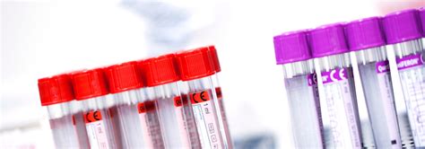 Quantiferon® Monitor Ssi Diagnostica