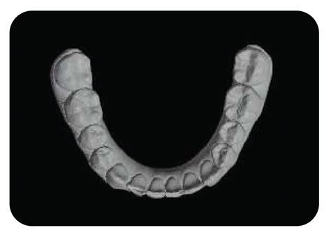 Occlusogram Ismartoffice
