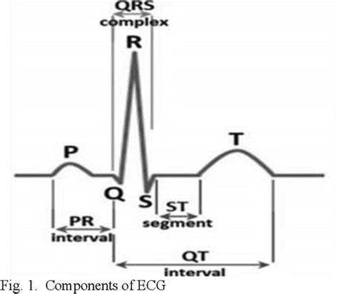 Figure 1 From Biometric Authentication System Based On Electrocardiogram Ecg Semantic Scholar