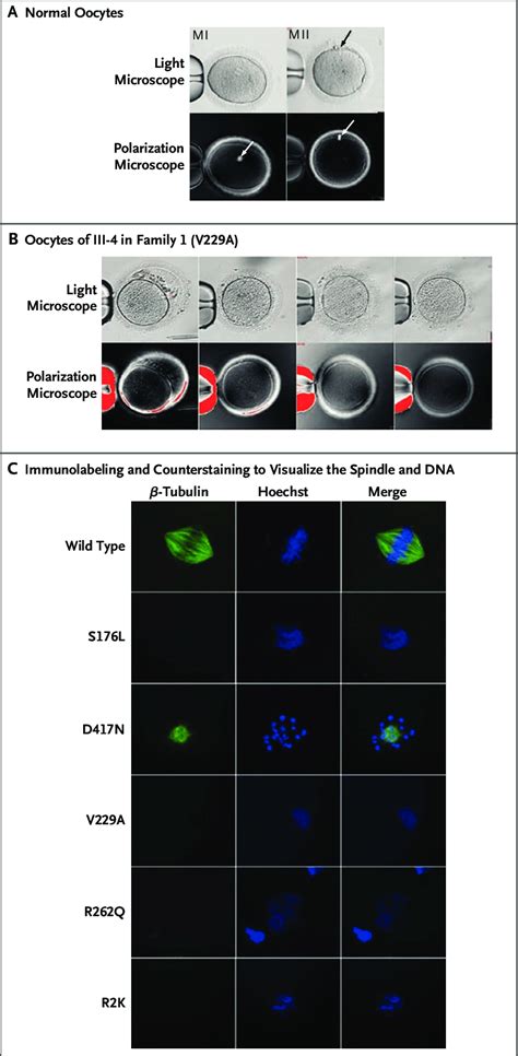 Phenotypes Of Oocytes With Maturation Arrest A Normal Oocyte Panel A Download Scientific