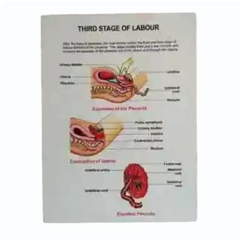 Wooden Board Third Stage Labour Chart At Best Price In Ambala Id 2853292220597
