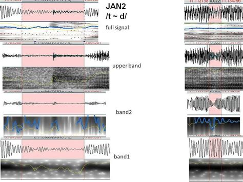 Left Hand Side Shows Typical Intervocalic T In A Time With The