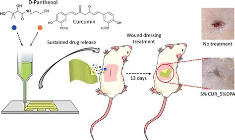 Polycaprolactonelignin Based 3d Printed Dressings Loaded With A
