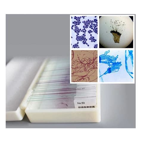 Candida Albicans Microscope Slide