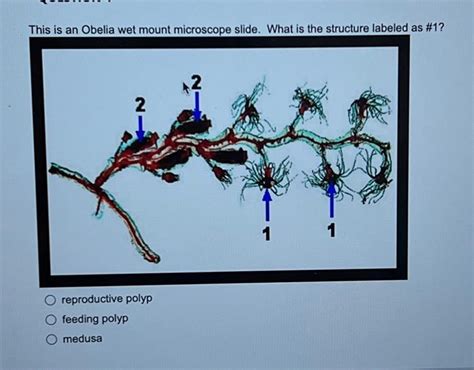 This Is An Obelia Wet Mount Microscope Slide What Is